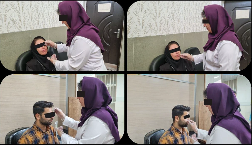 Identification of Demodex spp. (Acari: Demodicidae), Prevalence Human ...