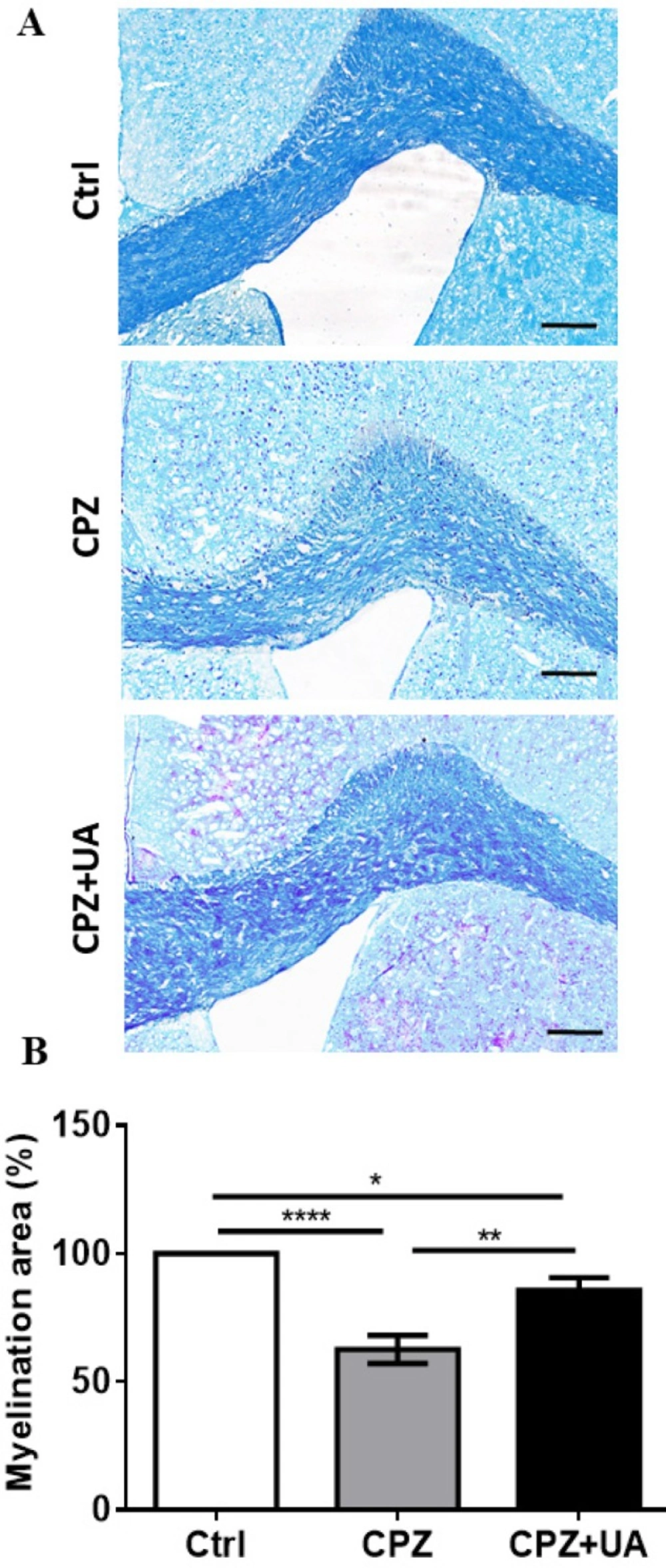 Myelin Protection by Ursolic Acid in Cuprizone-Induced Demyelination in ...