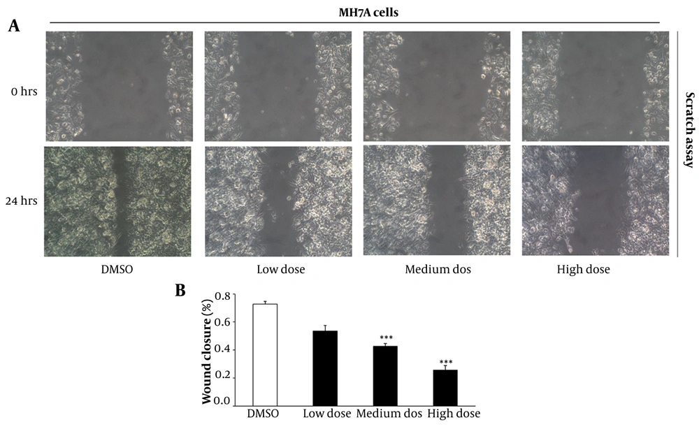 Dual TYK2/JAK1 Inhibition by Brepocitinib Reprograms Synoviocyte ...