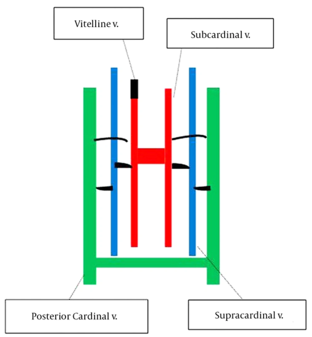 Unusual Pattern of Left Inferior Vena Cava: A Case Report