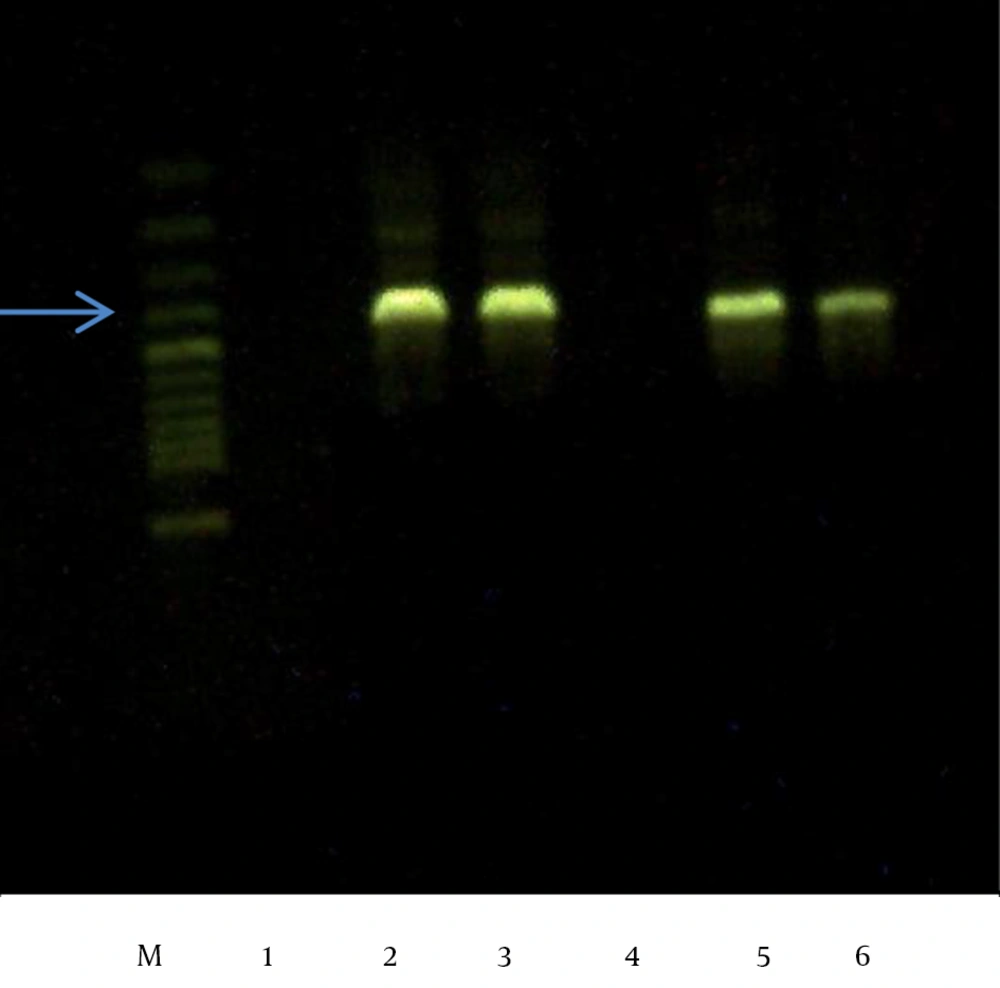Prevalence of AmpC β-lactamase in Clinical Isolates of Escherichia coli ...