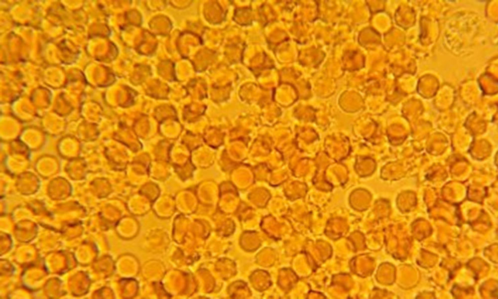In Vitro Impact of Treatment With Aqueous Extract of Cassia Fistula on ...